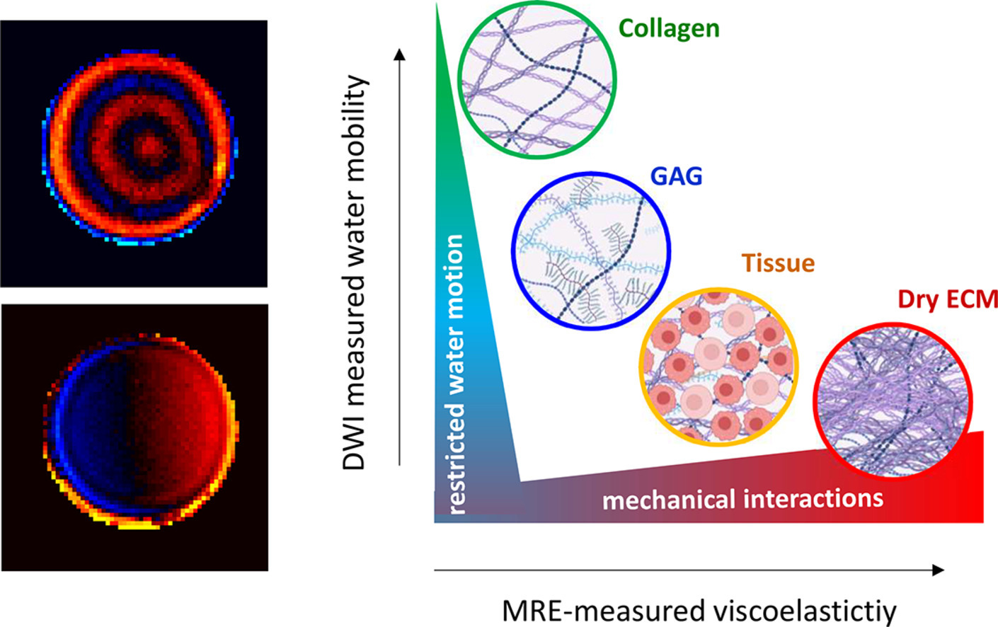 MRE | Magnetic Resonance Elastography - Pure Devices
